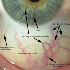 SCLEROLOGY WALLCHART – Grand Medicine Eyology | Iridology