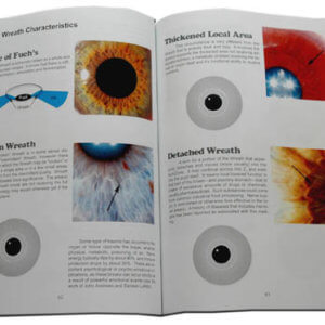 SCLEROLOGY WALLCHART – Grand Medicine Eyology | Iridology